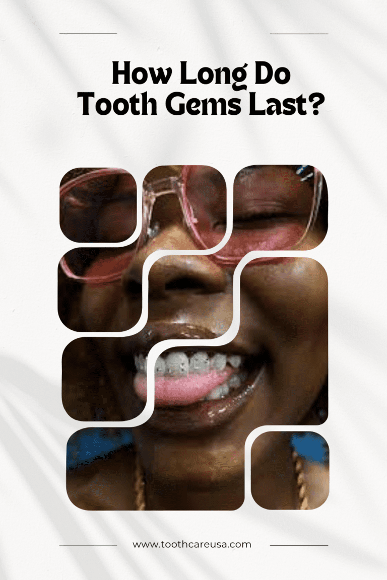 Tooth Gems 101: Cost, Application, Longevity & Everything You Need to ...