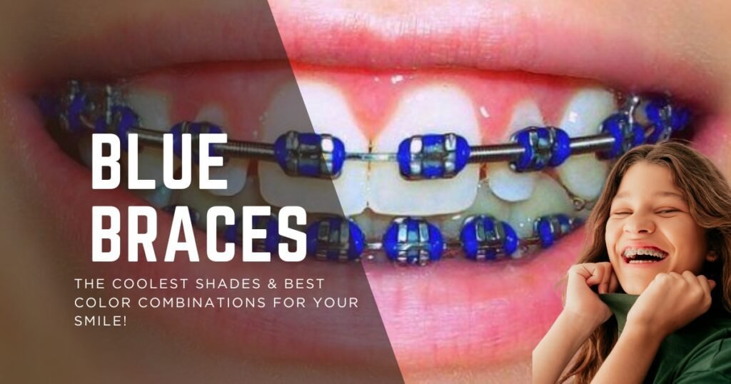 Blue Braces: The Coolest Shades & Best Color Combinations for Your Smile! - Toothcareusa.com