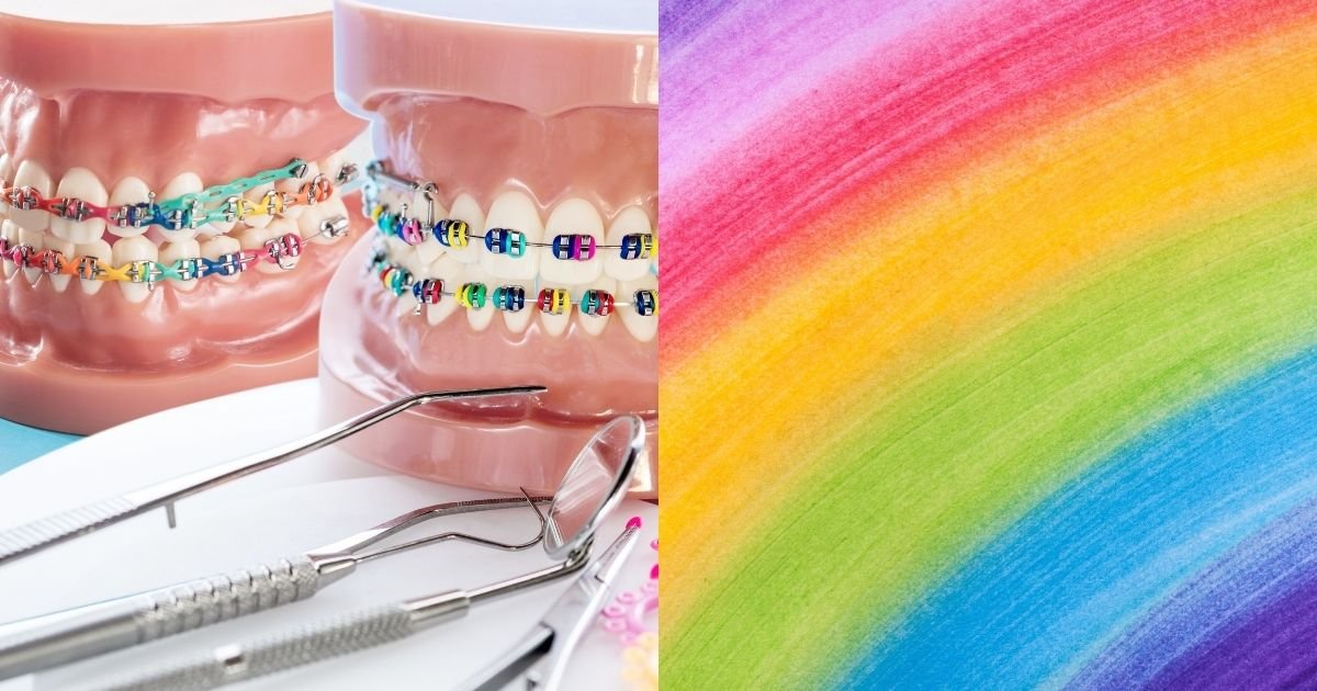 Braces Color Wheel: How to Pick the Perfect Shade for Your Smile ...