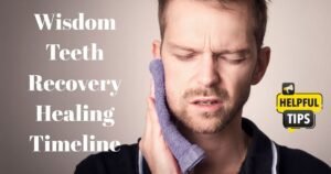 How Long Does Wisdom Teeth Recovery Take? Healing Timeline & 7 most ...