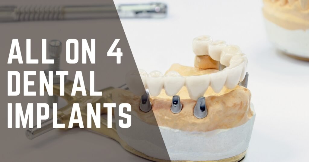 Endosteal Implants in 2025:Cost, Benefits & Step-by-Step Procedure Guide - toothcareusa.com